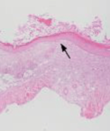 The Only OTC Cold Medicine from 100% Natural Ingredients – Biovanta